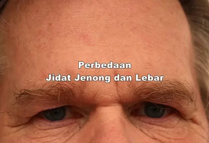 Tahu Gak? Perbedaan Jidat Jenong dan Lebar - Pembeda.id